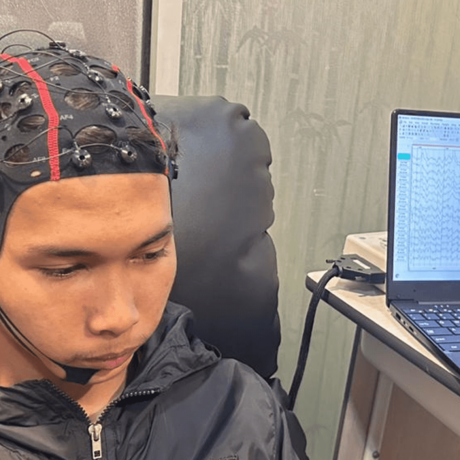 Brain Mapping (qEEG) - Klinik Talenta Center